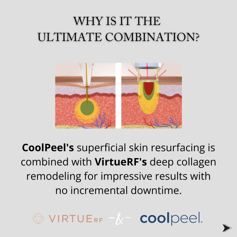 HELIX CoolPeel™ & Fusion for Albany & Latham, NY – Rockmore Plastic Surgery